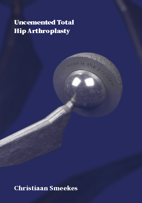 Uncemented Total Hip Arthroplasty · Gildeprint